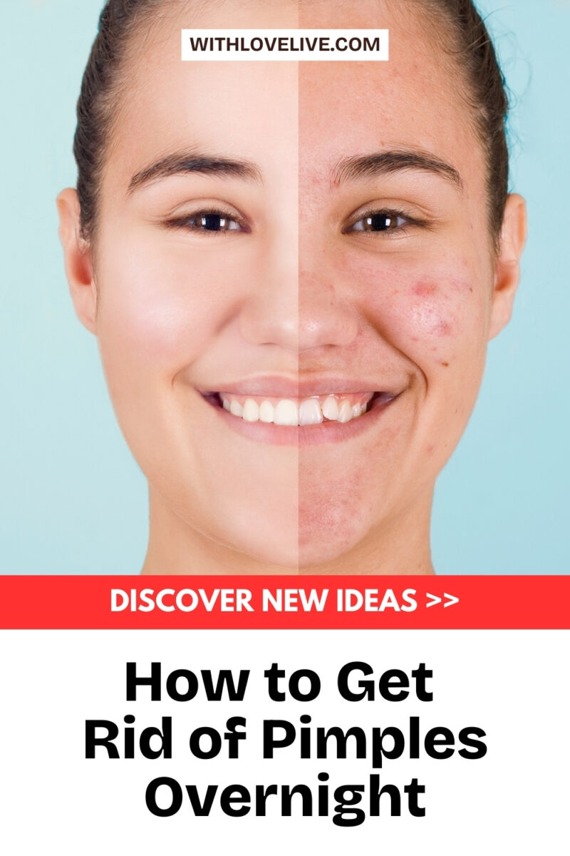 How to Get Rid of Pimples Overnight: Complete Guide - WithLoveLive